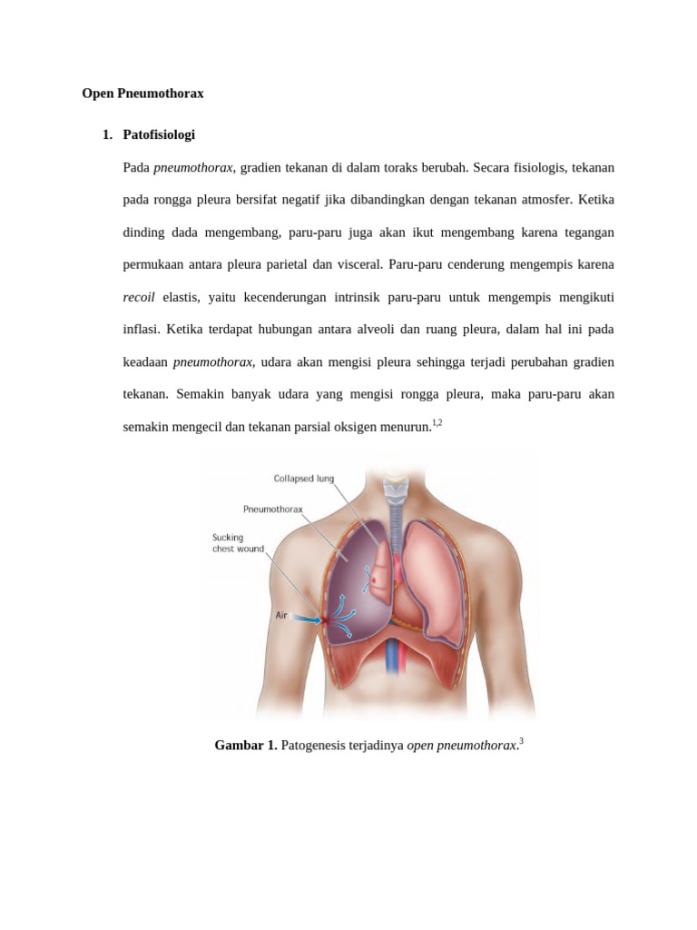 Open Pneumothorax | PDF