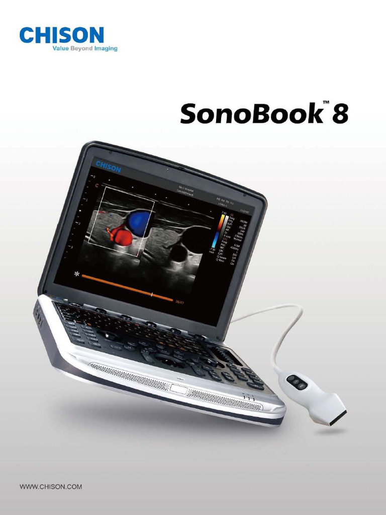 Chison SonoBook8 Brochure | PDF
