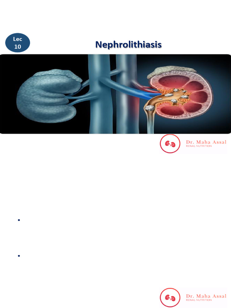Lec 10, Nephrolithiasis - 2IN1 | PDF | Medical Specialties | Urinary System