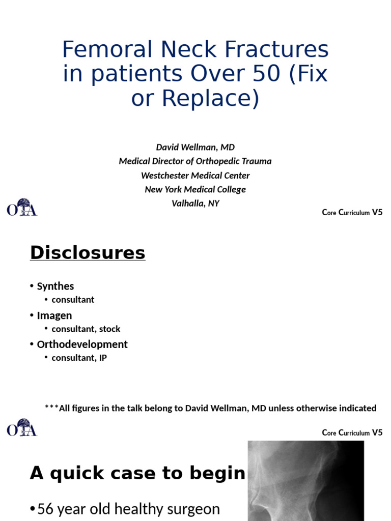Nof Fracture Less Then 50 | PDF | Hip | Surgical Specialties