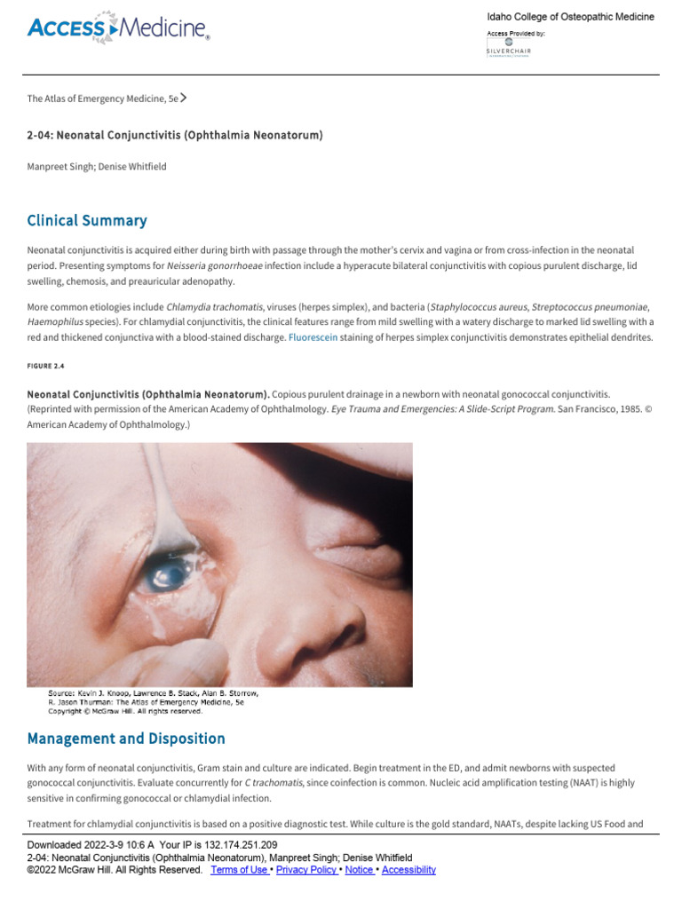 2-04 - Neonatal Conjunctivitis (Ophthalmia Neonatorum) | PDF | Diseases ...