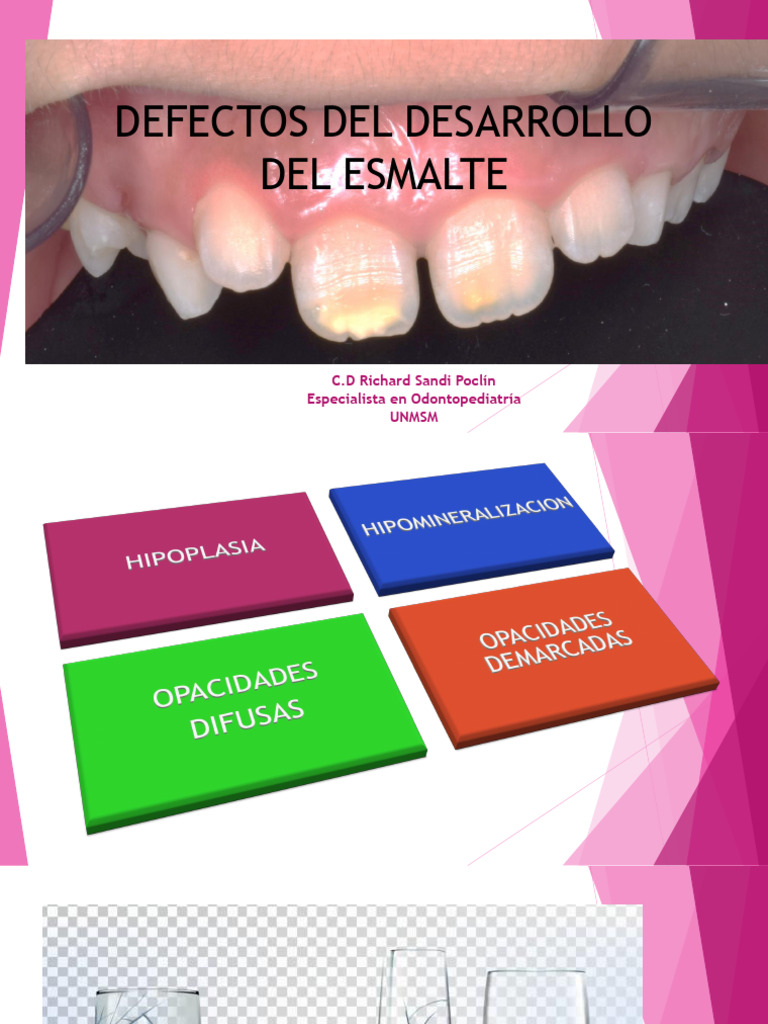 Defectos del Esmalte Dental: Tipos y Causas | PDF | Ramas de ...