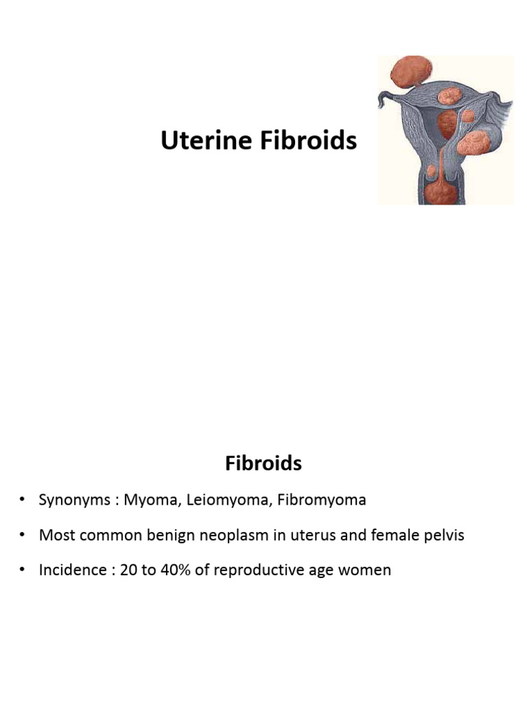 Fibroid_presentation.pptx.PDF [Kartikey Sharma] | PDF | Medical Specialties | Diseases And Disorders