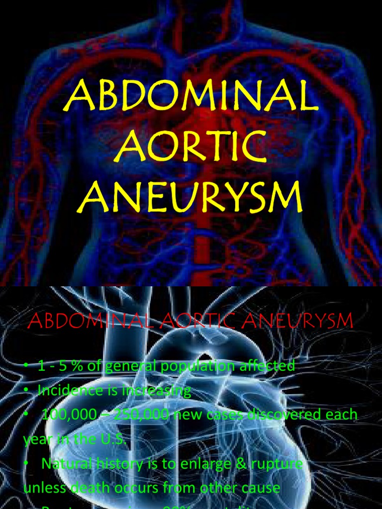 Abdominal Aortic Aneurysm | PDF | Aorta | Angiology