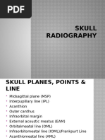Paranasal Sinuses X-Ray Techniques | PDF | Otorhinolaryngology | Human ...