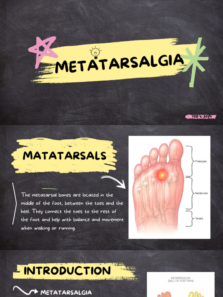 Metatarsalgia Exercise Guide | PDF