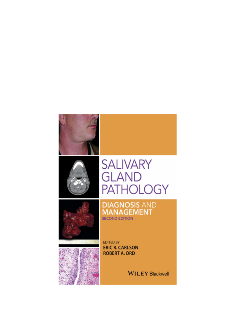 Salivary Gland Pathology Diagnosis and Management 2nd Edition PDF Download | PDF | Bible ...