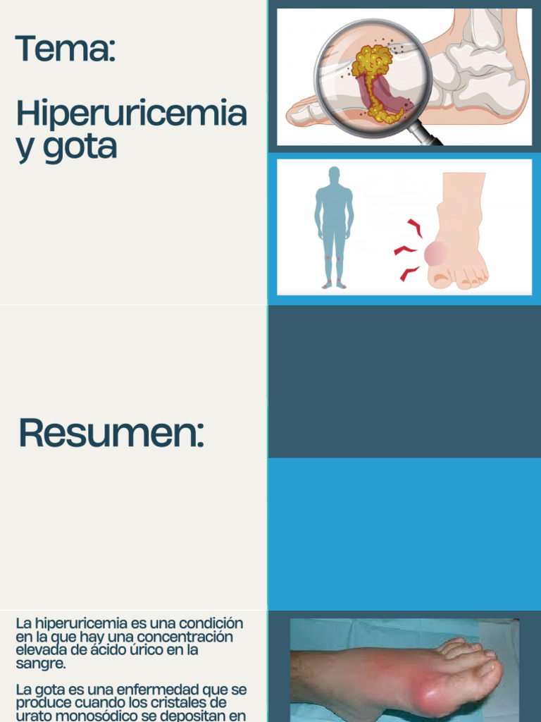 Hiperuricemia y Gota | PDF