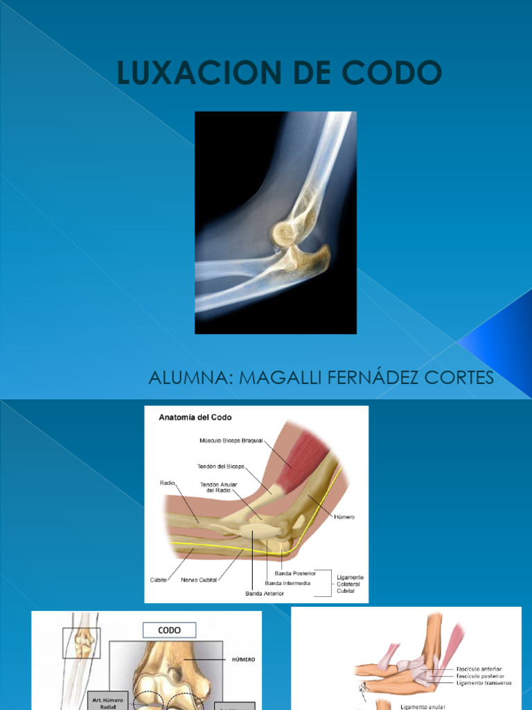LUXACION DE CODO | PDF | Codo | Anatomía humana