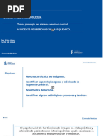 Escala ASPECTS | PDF