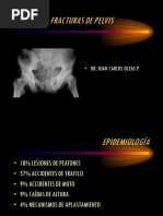 Fracturas de Cotilo | PDF | Pelvis | Sistema esquelético