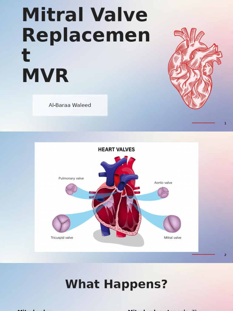 MVR Mitral Valve Replacement | PDF | Heart Valve | Heart