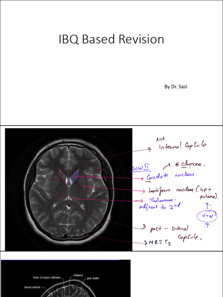IBQ Revision by DR Sasi Day 2 - Annoted | PDF | Diseases And Disorders ...