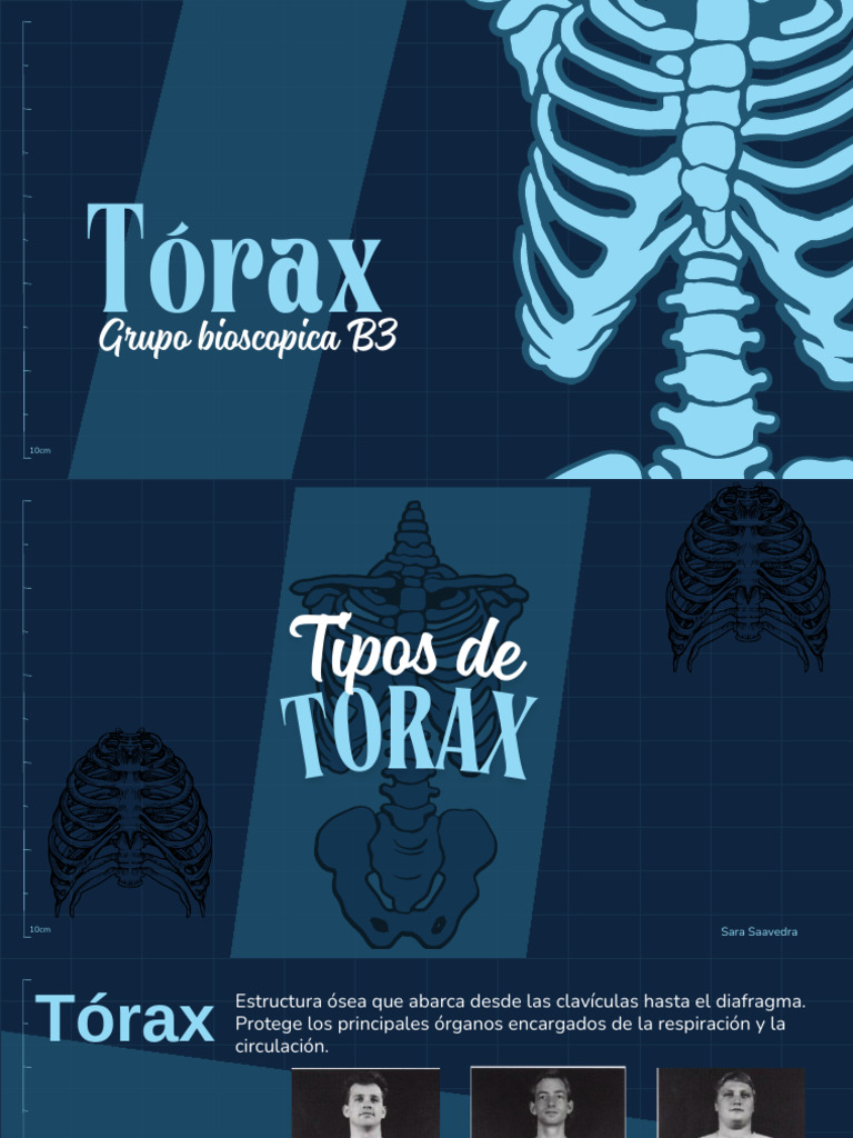 Tórax Escoliótico: Estructura y Patologías | PDF | Tórax | Sistema ...