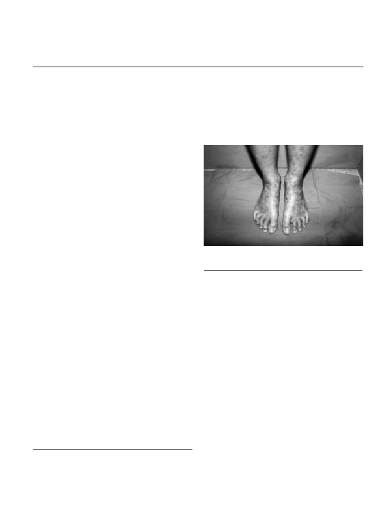 Purpura de Schamberg | PDF | Especialidades Medicas | Enfermedades y ...