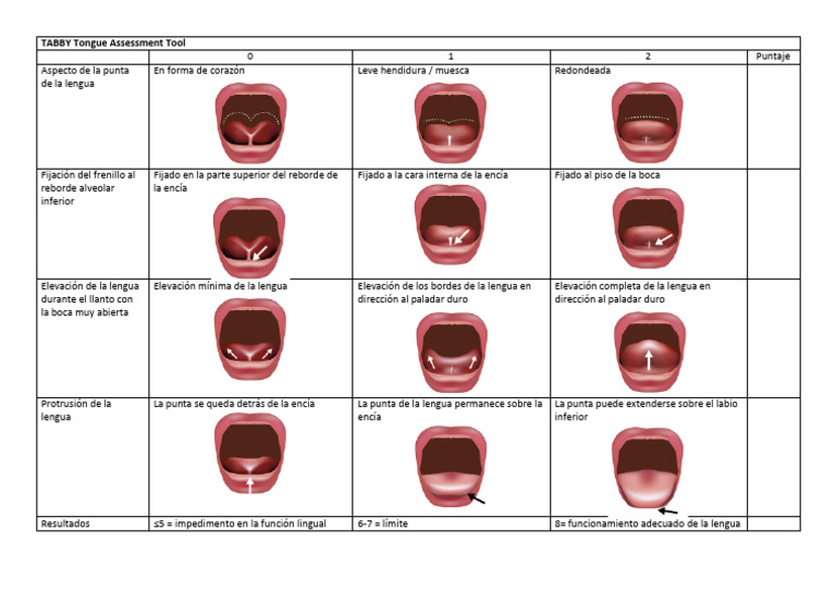 Herramienta de Evaluación TABBY | PDF