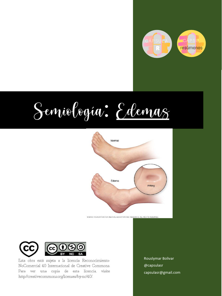 Edema | PDF | Edema | Especialidades Medicas