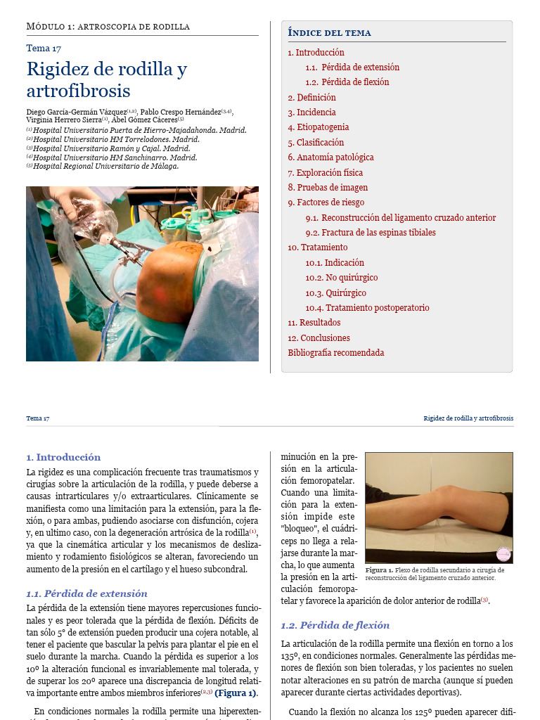 Rigidez y Artrofibrosis de Rodilla | PDF | Rodilla | Articulaciones