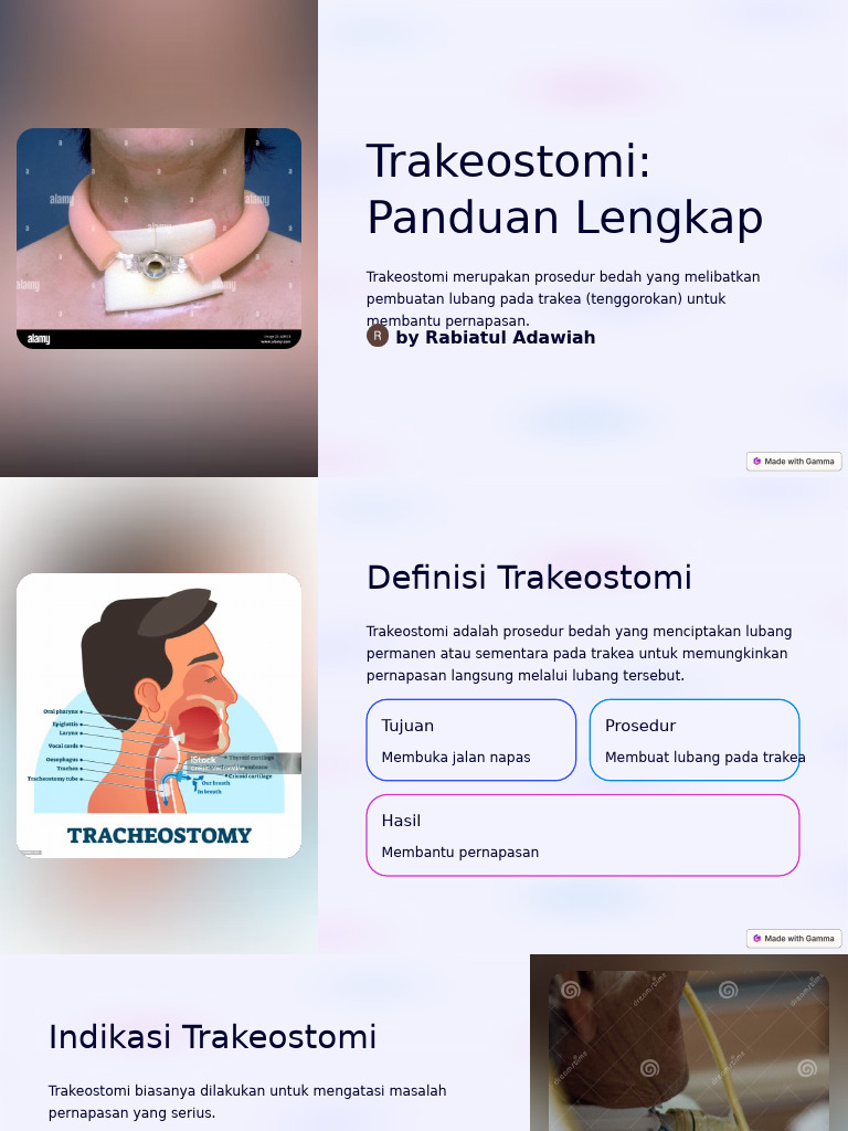 Trakeostomi-Panduan-Lengkap | PDF