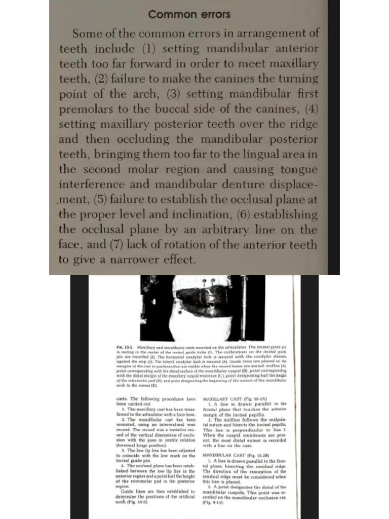 Prostho Processing The Denture | PDF