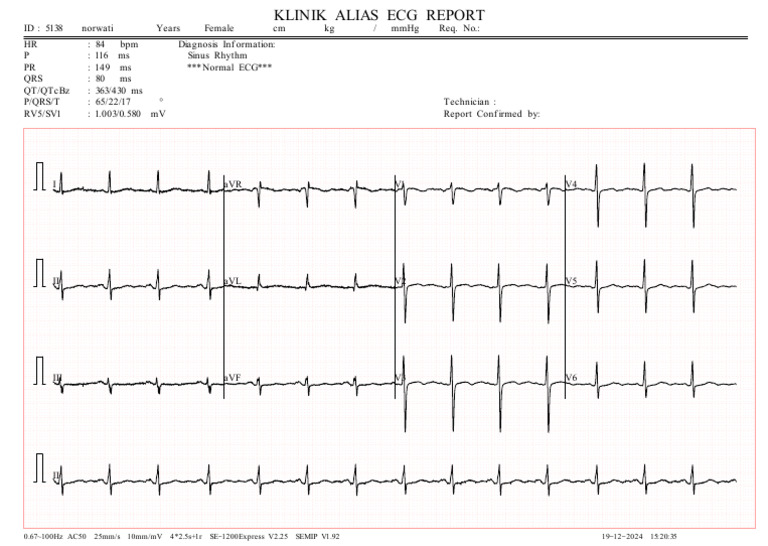Ecg Norwati 5138 | PDF