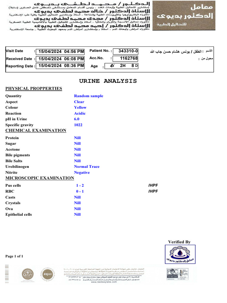 Urine Analysis Report Summary | PDF
