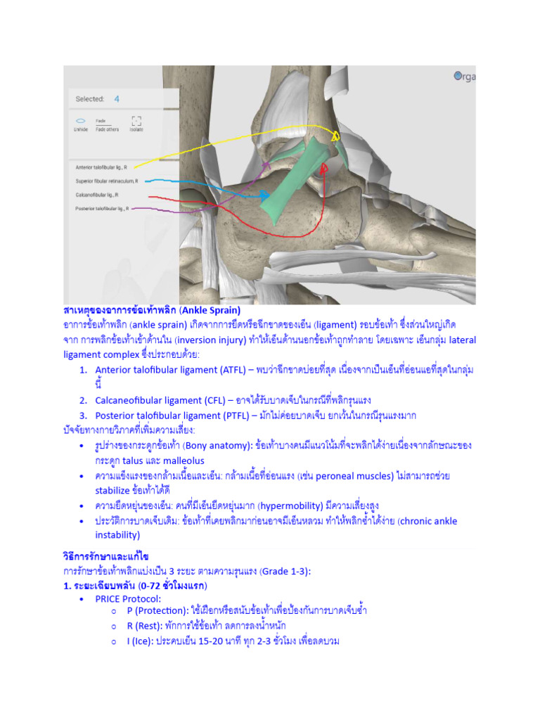 Ankle Sprain | PDF