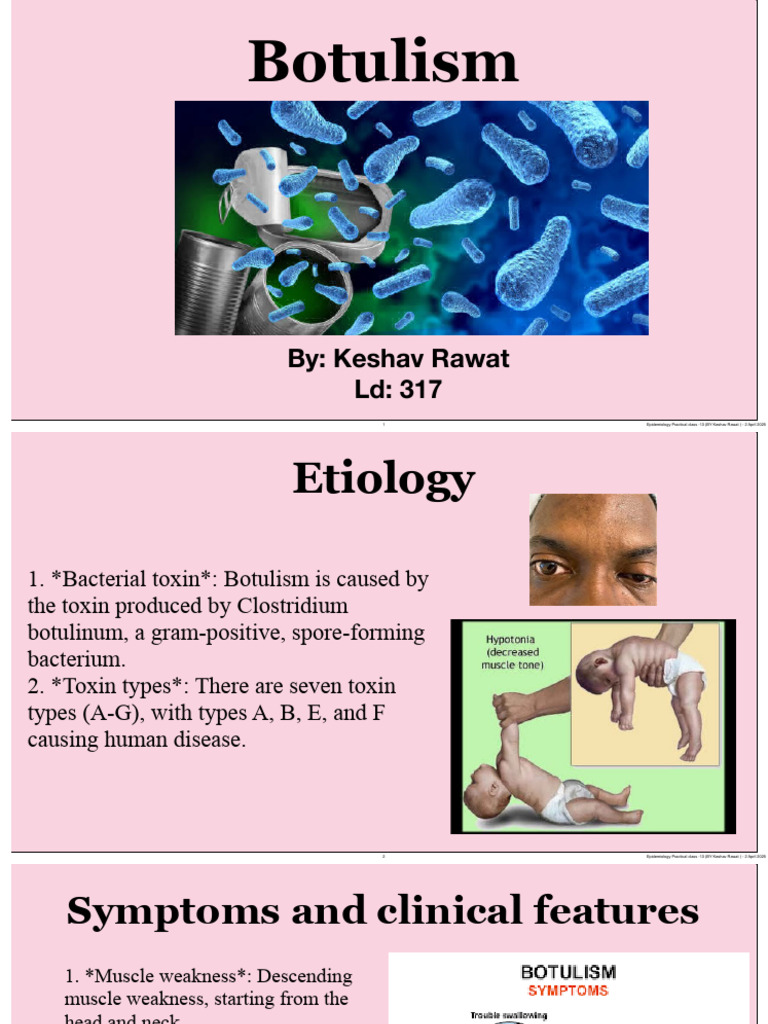 Epidemiology Practical Class - 13 (By Keshav Rawat) | PDF | Botulinum ...