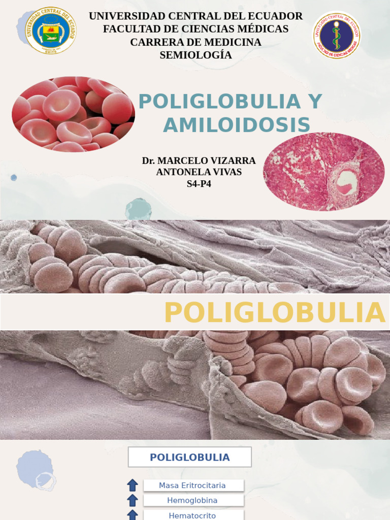 Poliglobulia: Diagnóstico y Tratamiento | PDF | Enfermedades y ...