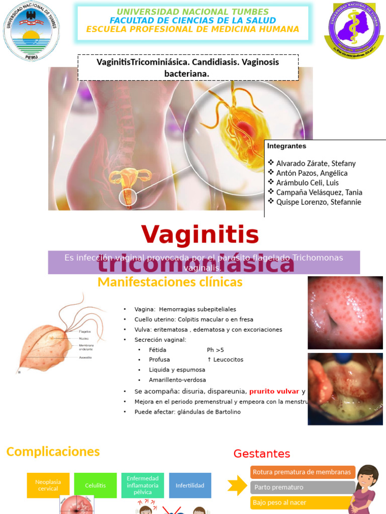 VaginitisTricominiásica. Candidiasis. Vaginosis Bacteriana. Vaginitis Senil - Quiste de ...