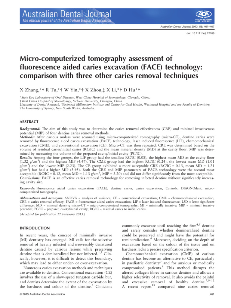 Micro-Computerized Tomography Assessment of | PDF | Dentin | Human Tooth