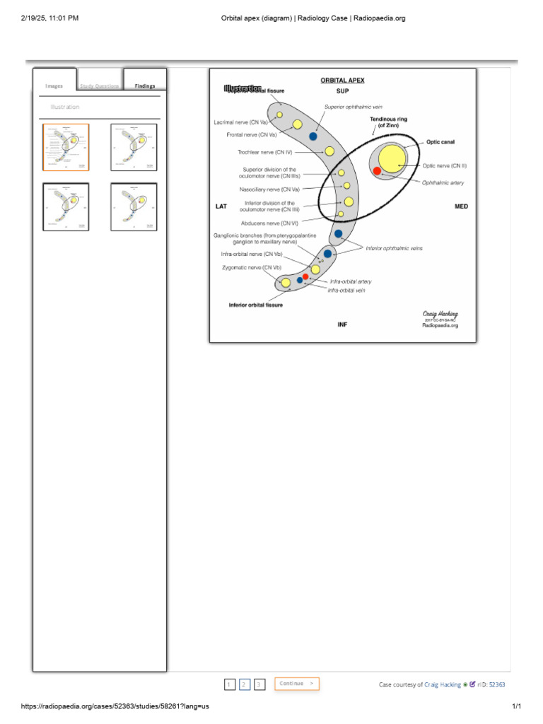 Orbital Apex (Diagram) - Radiology Case | PDF