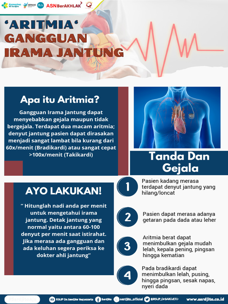 Aritmia Gangguan Irama Jantung | PDF