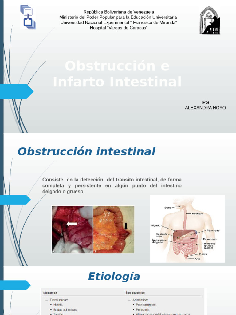 Obstrucion Intestinal e Infarto | PDF | Isquemia | Trombo