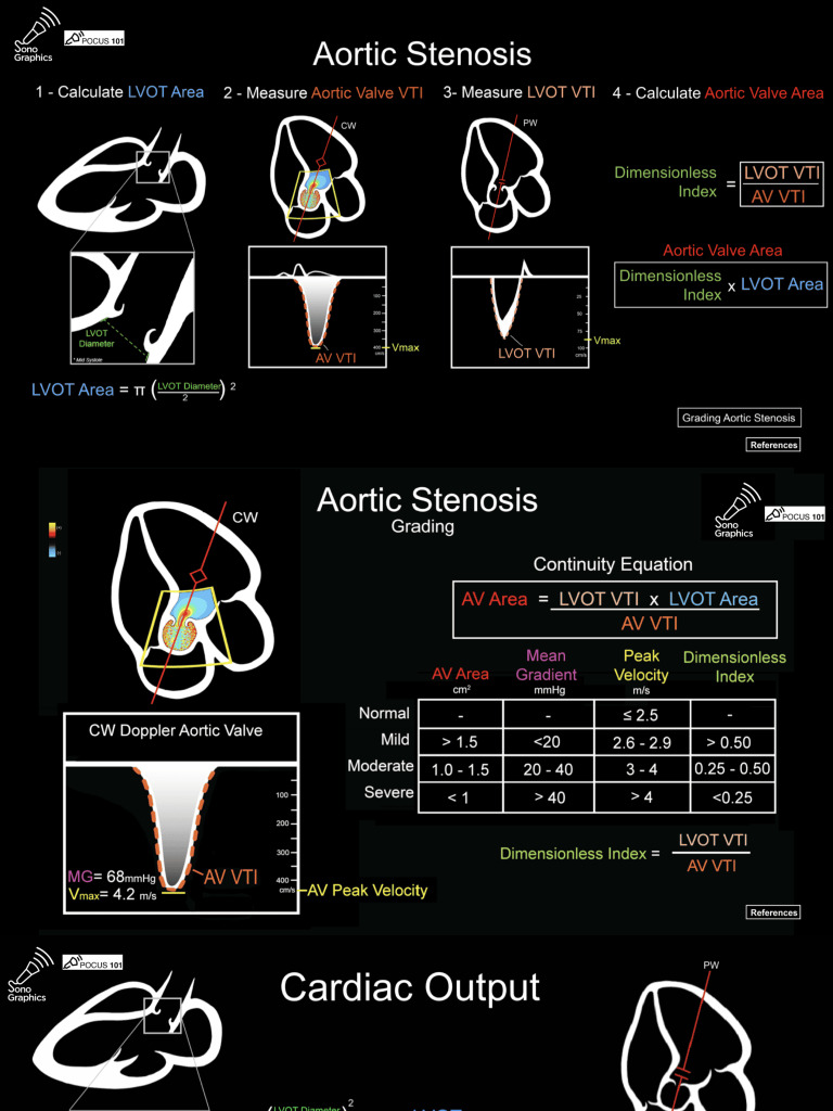 Pocket Cards Pocus Tte & Tee From Pocus101 | PDF