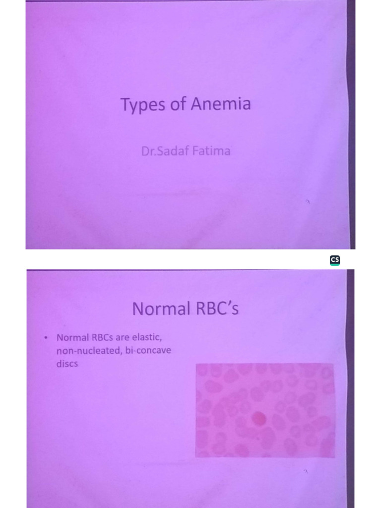 Types of Anemia | PDF