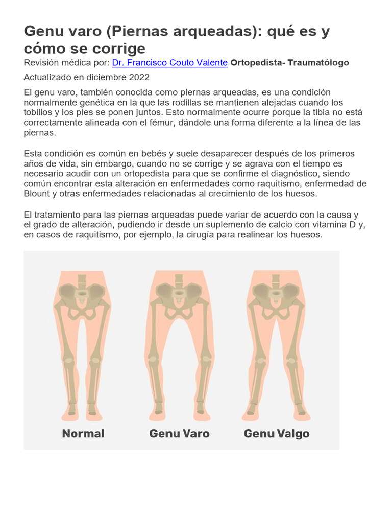 Ejercicios para Genu Varo Piernas Arqueadas) | PDF | Rodilla ...