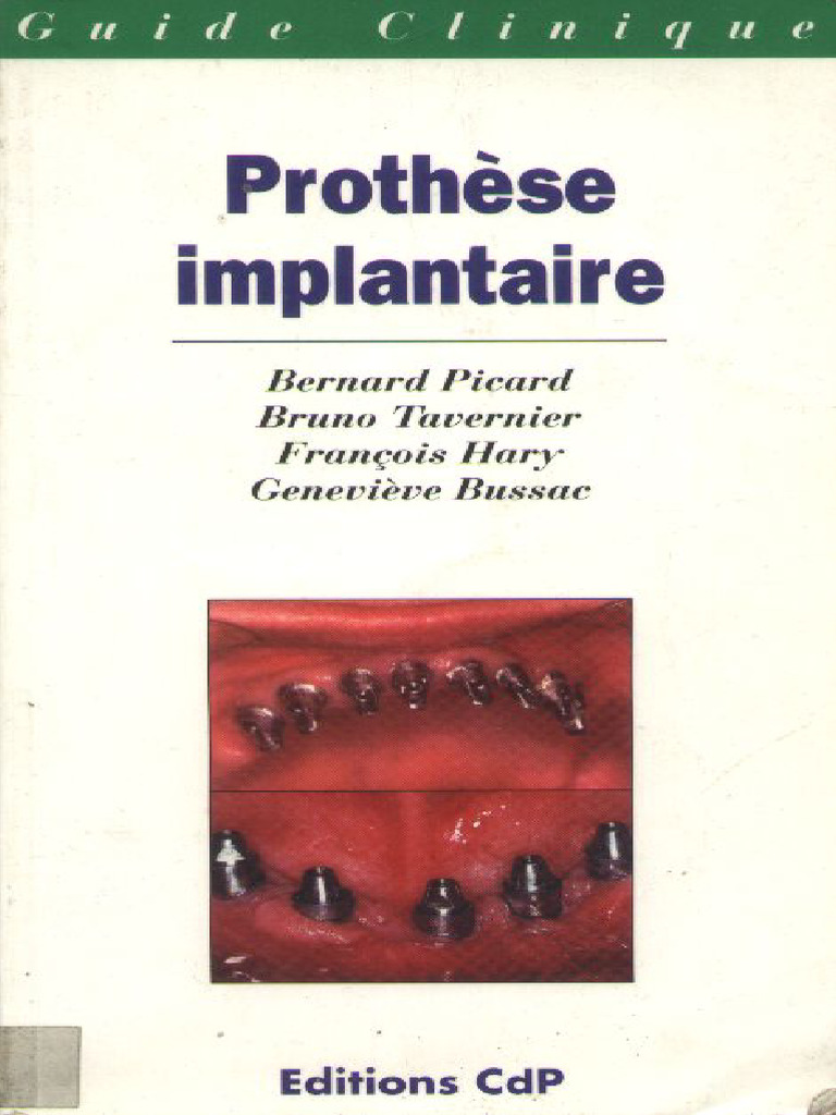 Prothèse Implantaire - Picard | PDF
