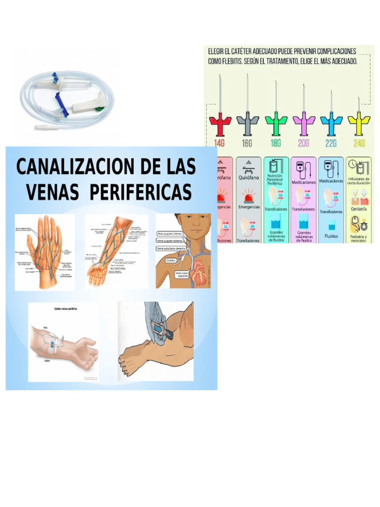 Meterial para Venopuncion | PDF