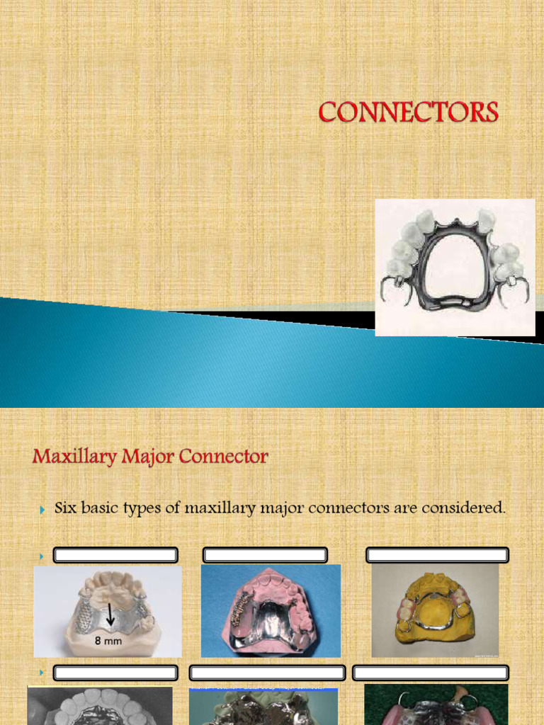 Major Connector - Mandibular | PDF | Dentistry Branches | Mouth