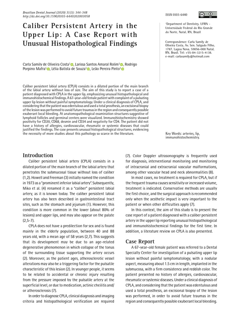 Artéria Labial de Calibre Persistente No Lábio Inferior - Um Relato de ...