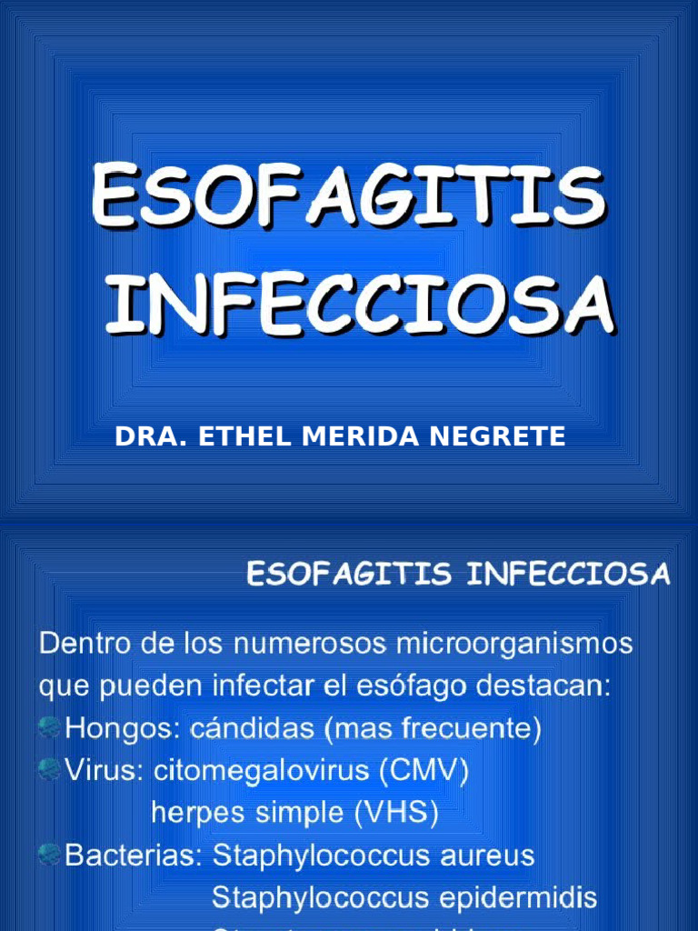 ESOFAGITIS INFECCIOSA | PDF