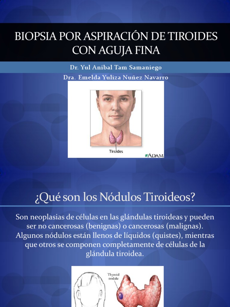 Biopsia de Tiroides | PDF | Tiroides | Biopsia