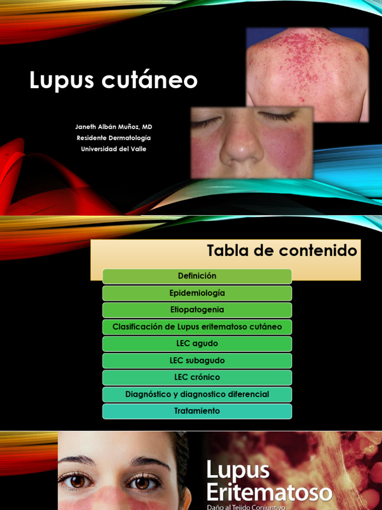 Clasificación del Lupus Cutáneo | PDF | Enfermedad autoinmune ...