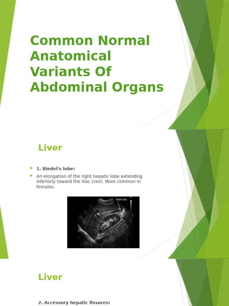 Common Normal Anatomical Variants of Abdominal Organs | PDF