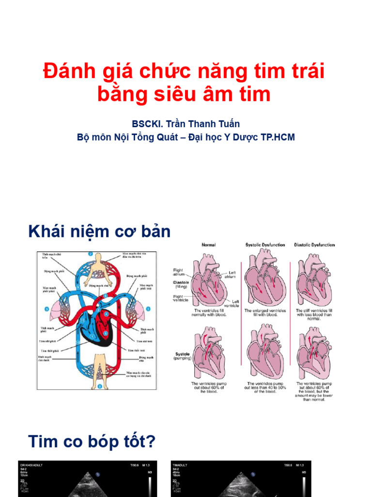 3.Đánh giá chức năng tim trái bằng siêu tim | PDF