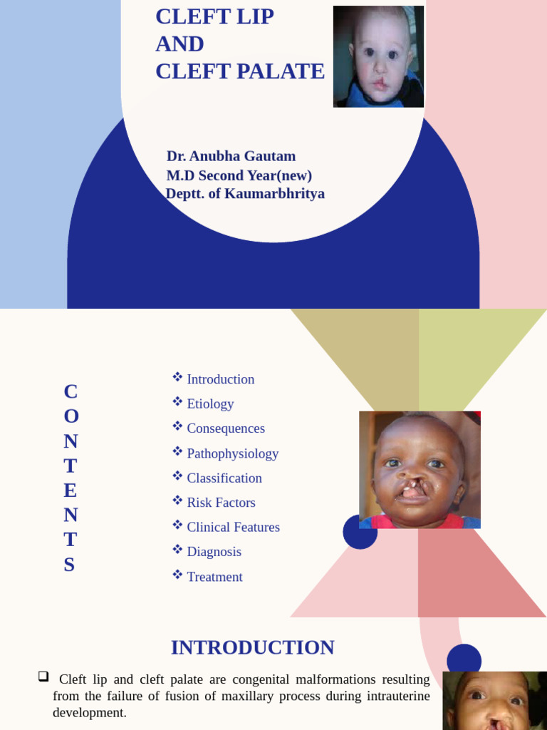 Cleft Lip and Cleft Palate(1) | PDF | Human Nose | Medical Specialties