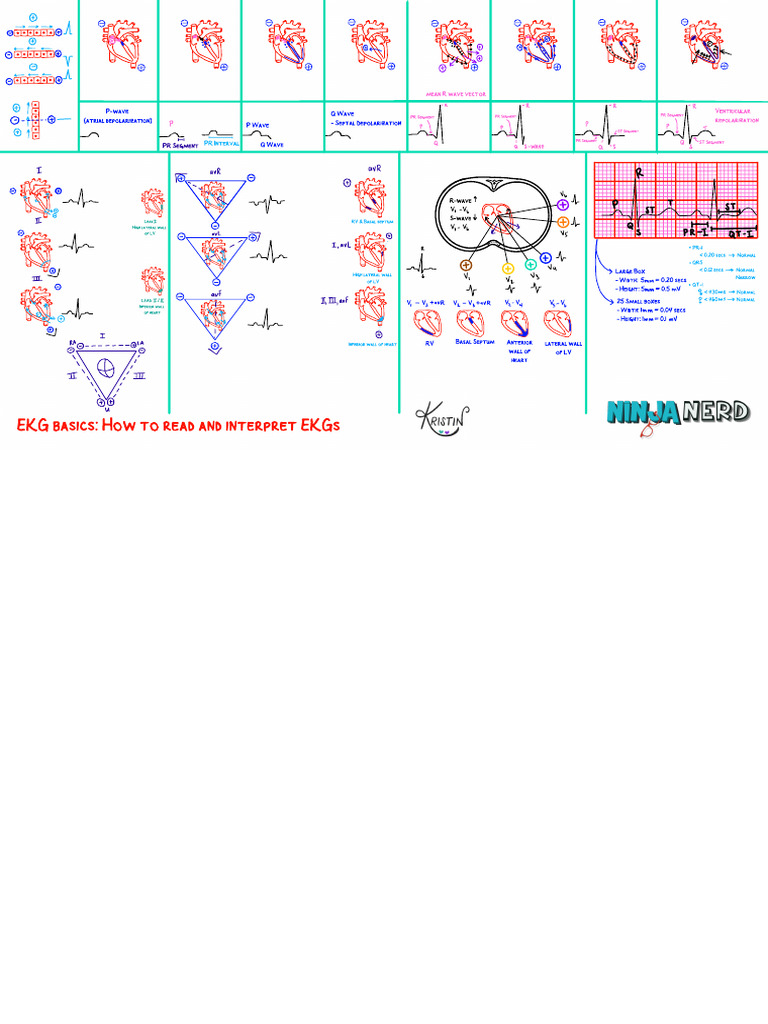EKG Basics (new) Illustration atf | PDF
