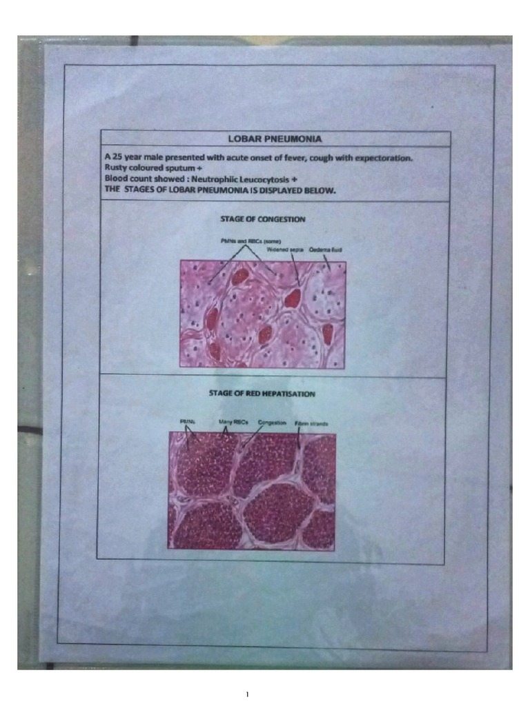 CV & RS Charts | PDF