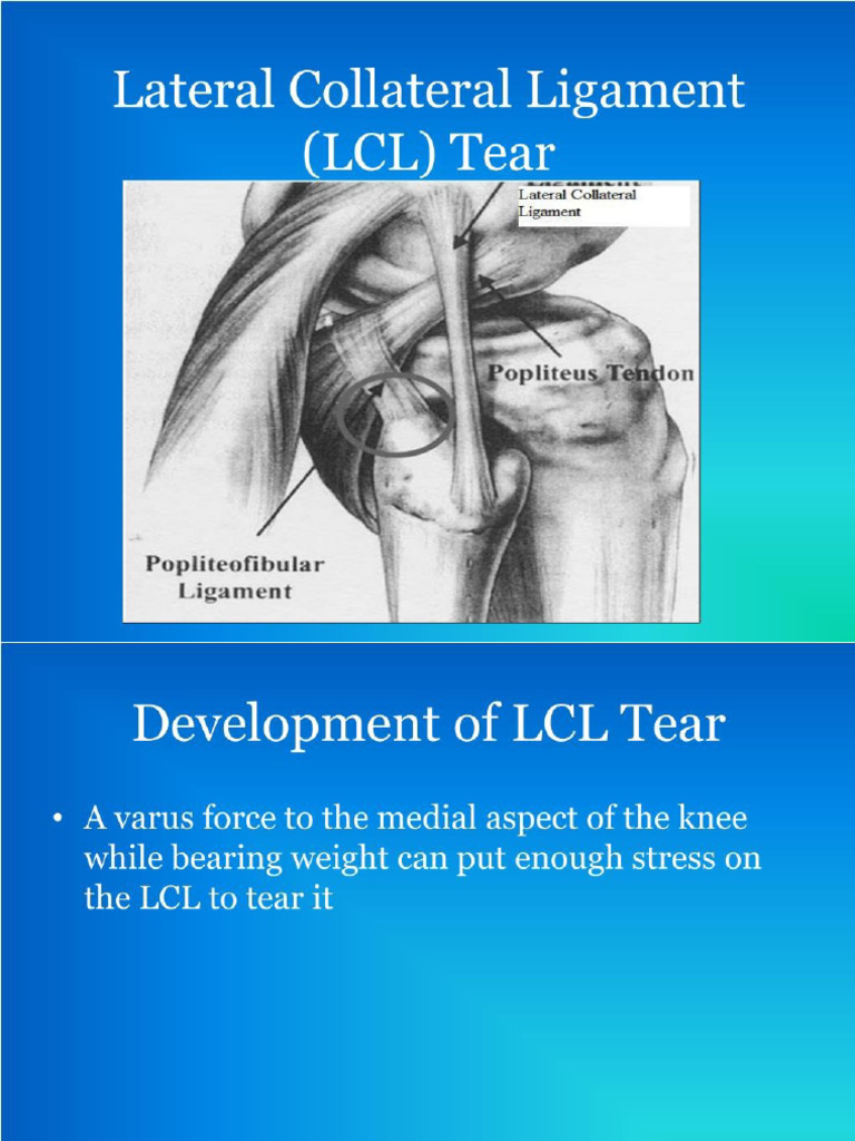 Lateral Collateral Ligament Injury | PDF